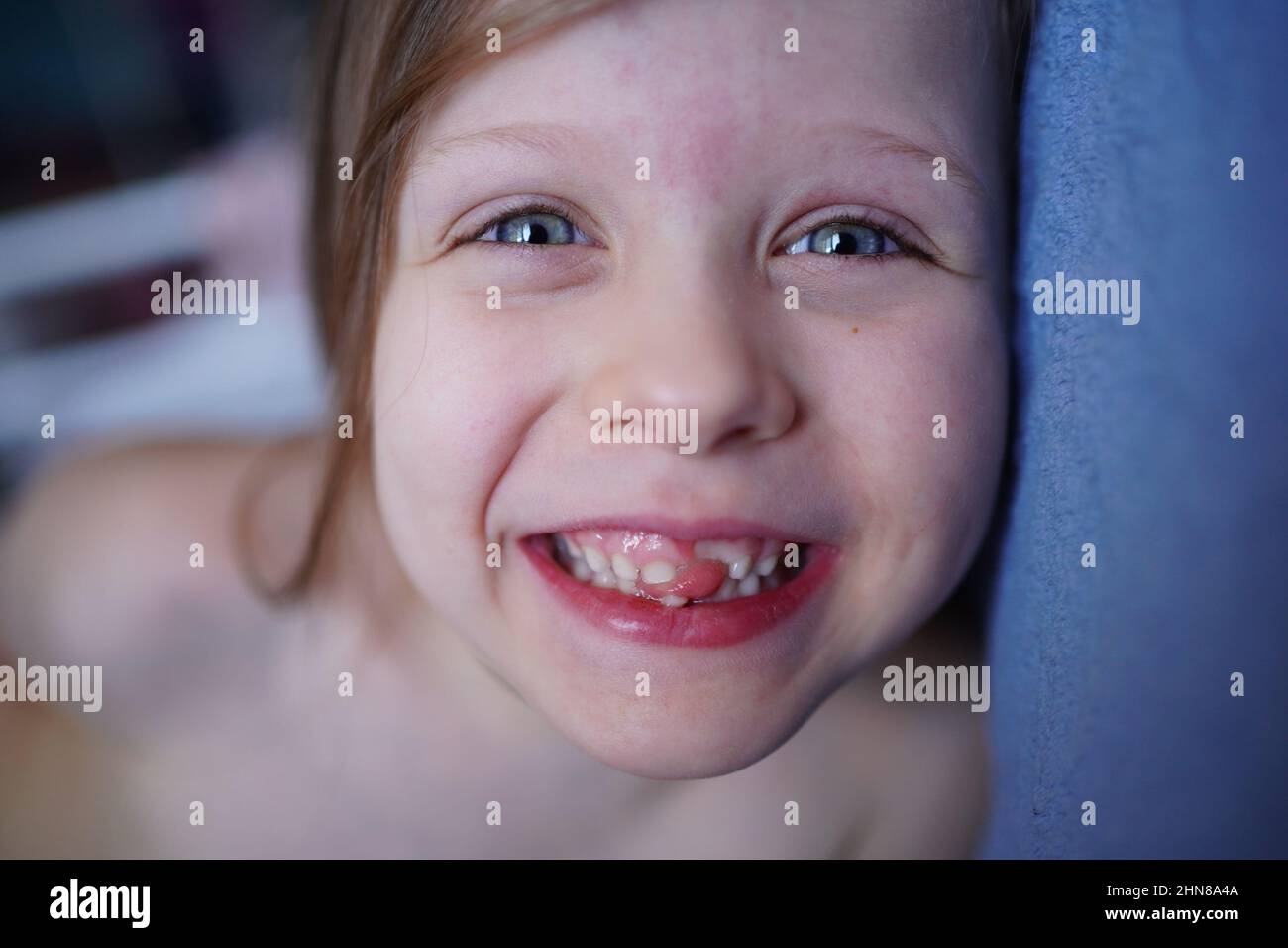 cheerful girl without front teeth Stock Photo - Alamy