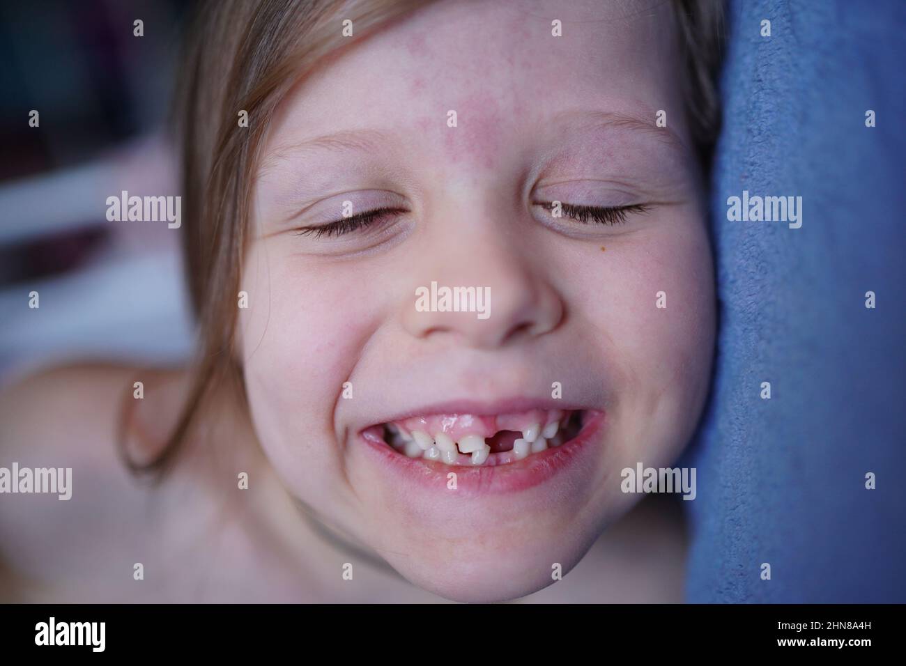 cheerful girl without front teeth Stock Photo - Alamy