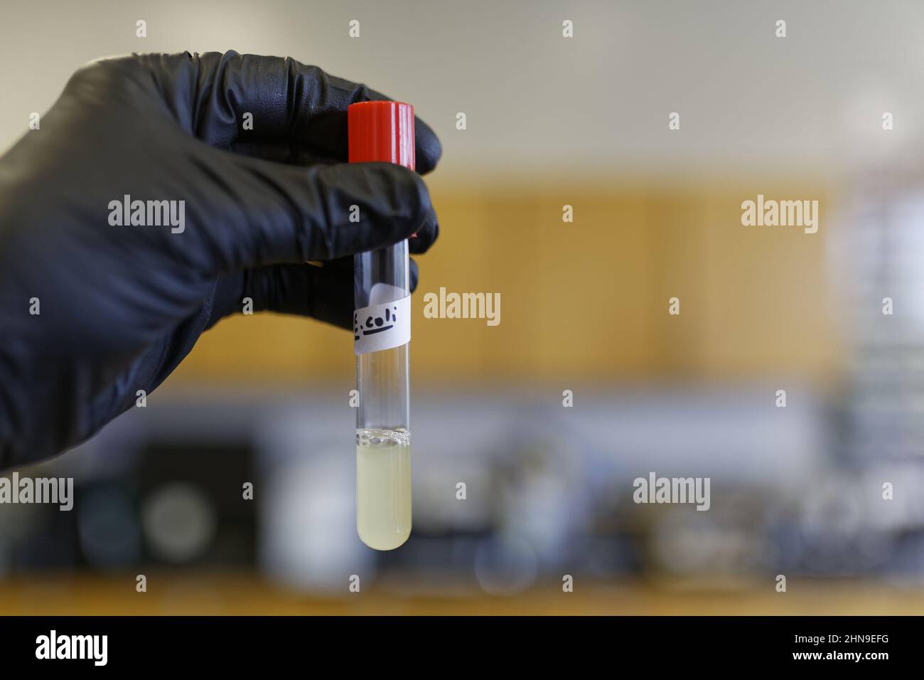 E. coli culture in a test tube Stock Photo - Alamy