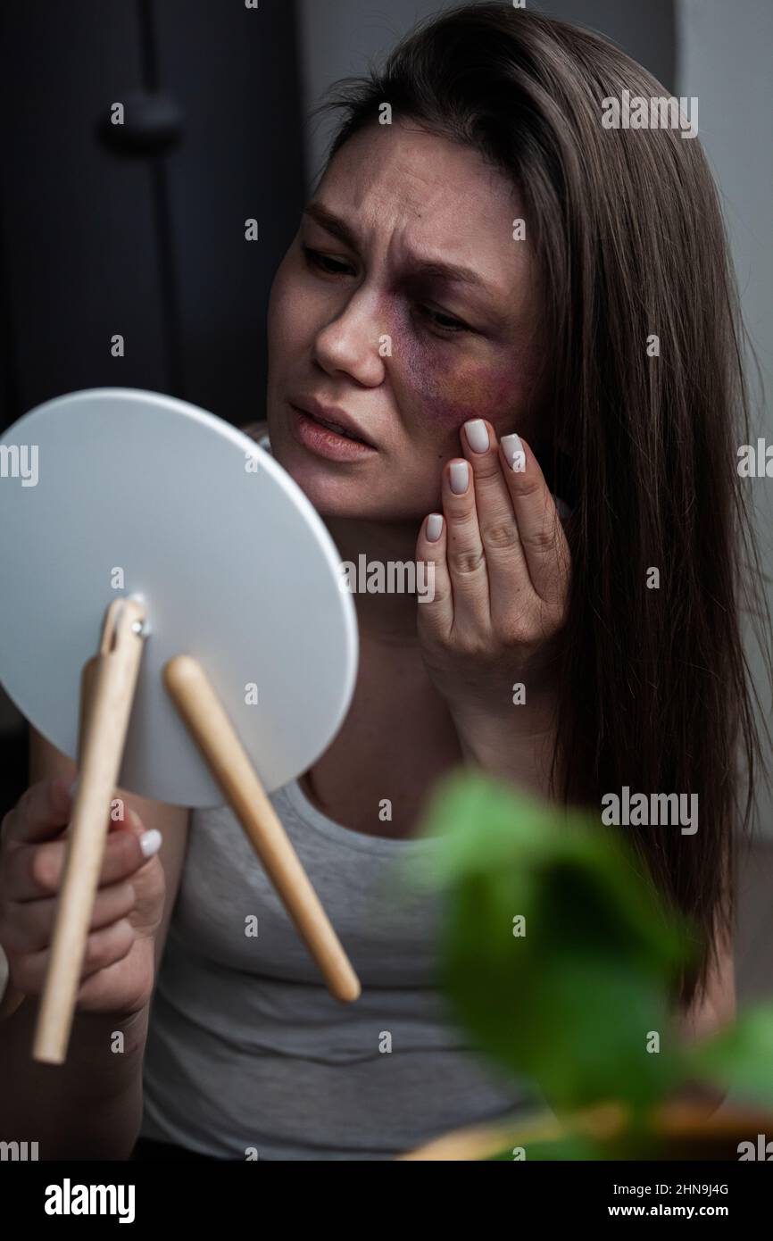 Domestic violence, abuse woman with bruise on face by the window looks ...