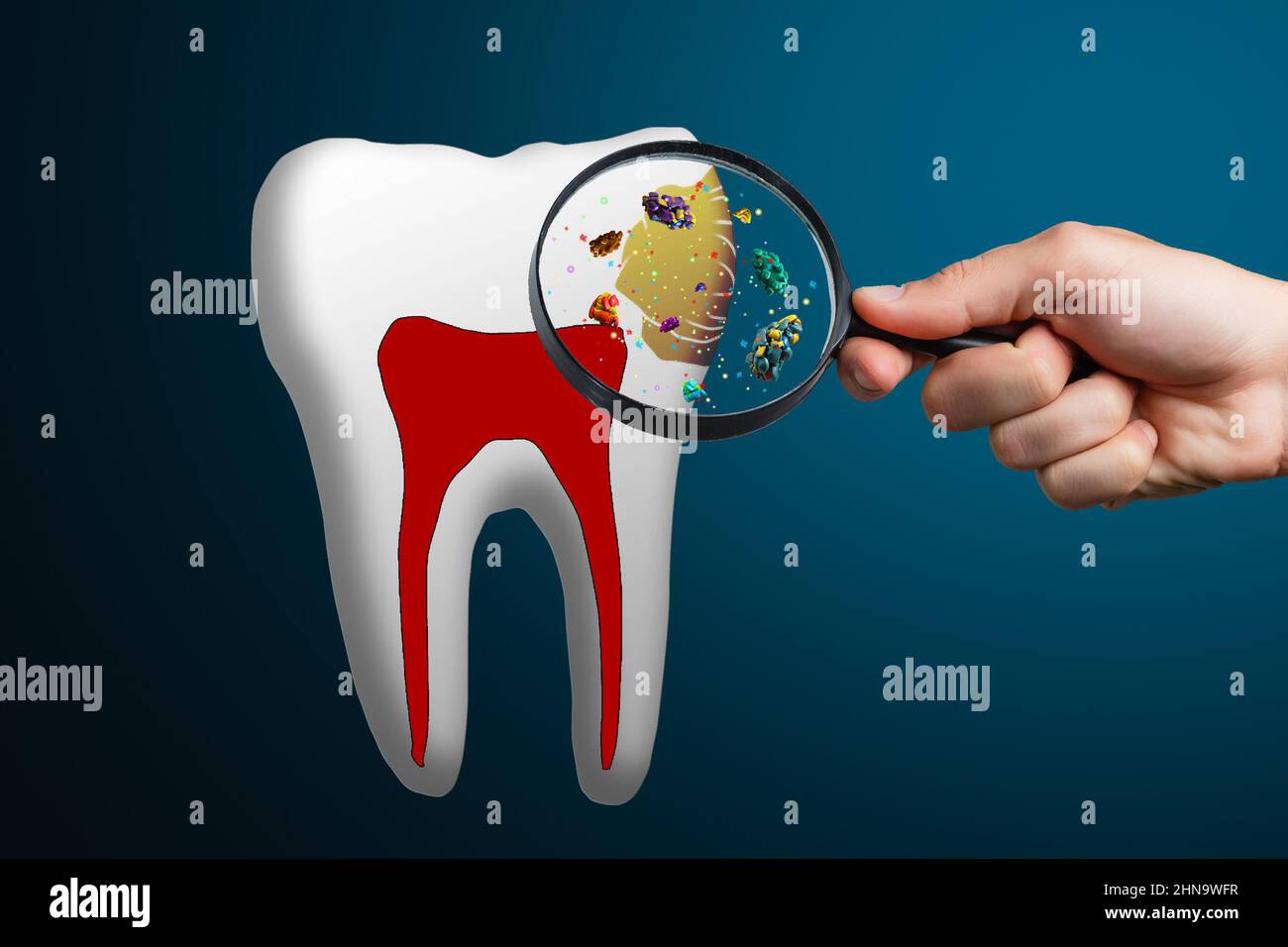Spoiled, rotten tooth concept illustration. Isolated background Stock ...