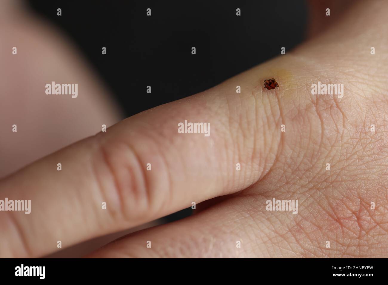 Detailed picture of insect Stock Photo - Alamy