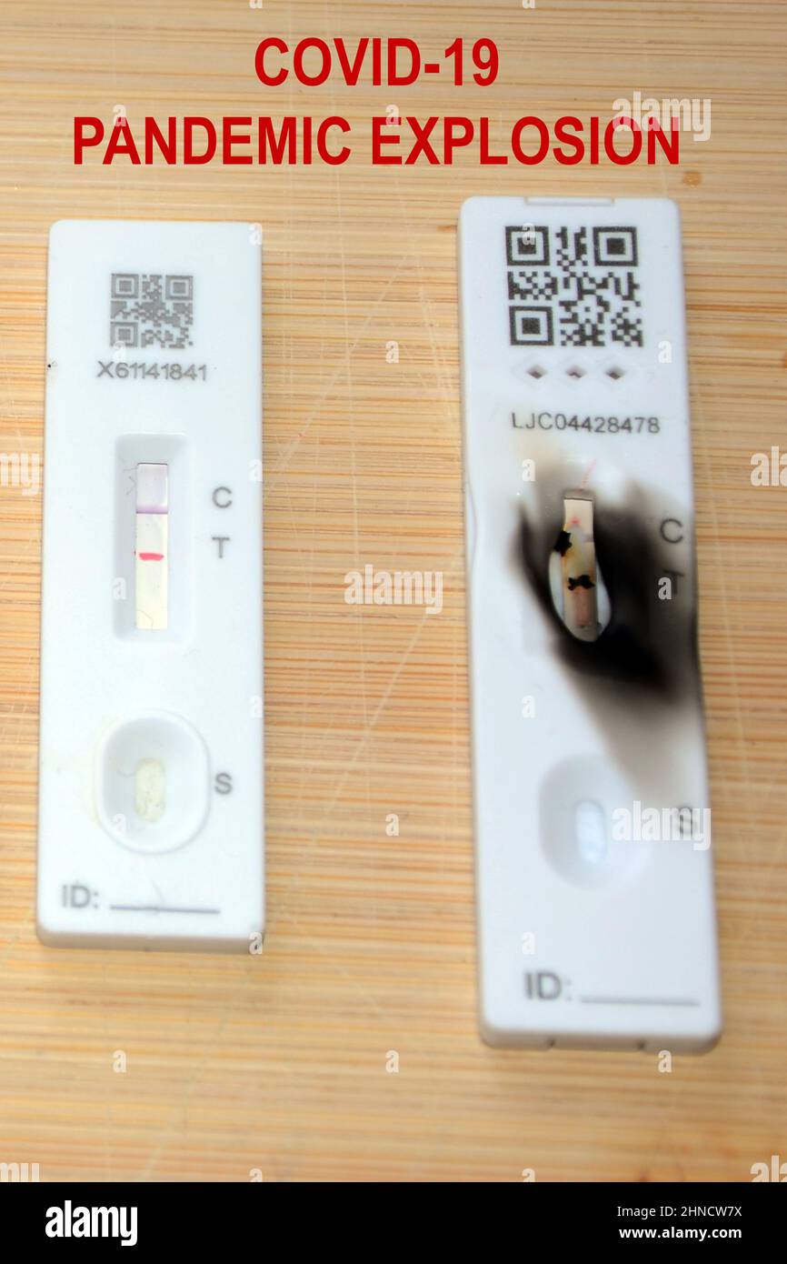 Lateral flow immunochromatographic hi-res stock photography and images ...