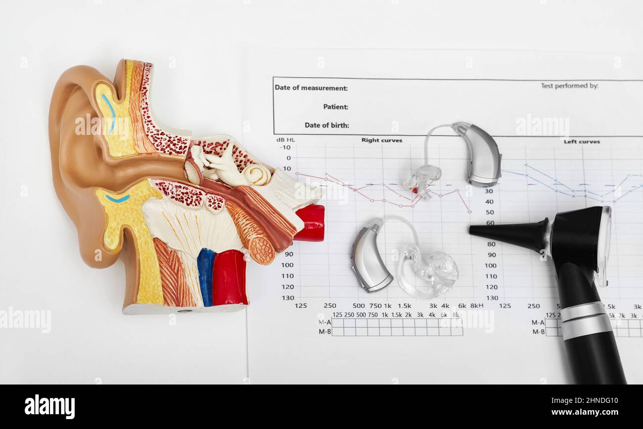Hearing test concept. Result of hearing exam - audiogram, hearing aids ...