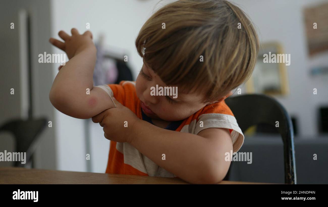 Kid showing mosquito bite child shows insect bite in arm Stock Photo ...