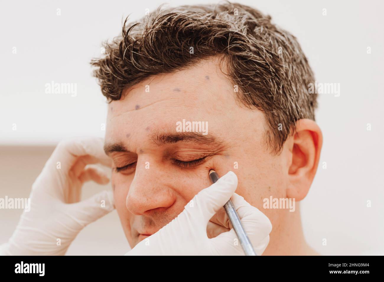 Doctor Cosmetologist prepares man's face for botox injections ...