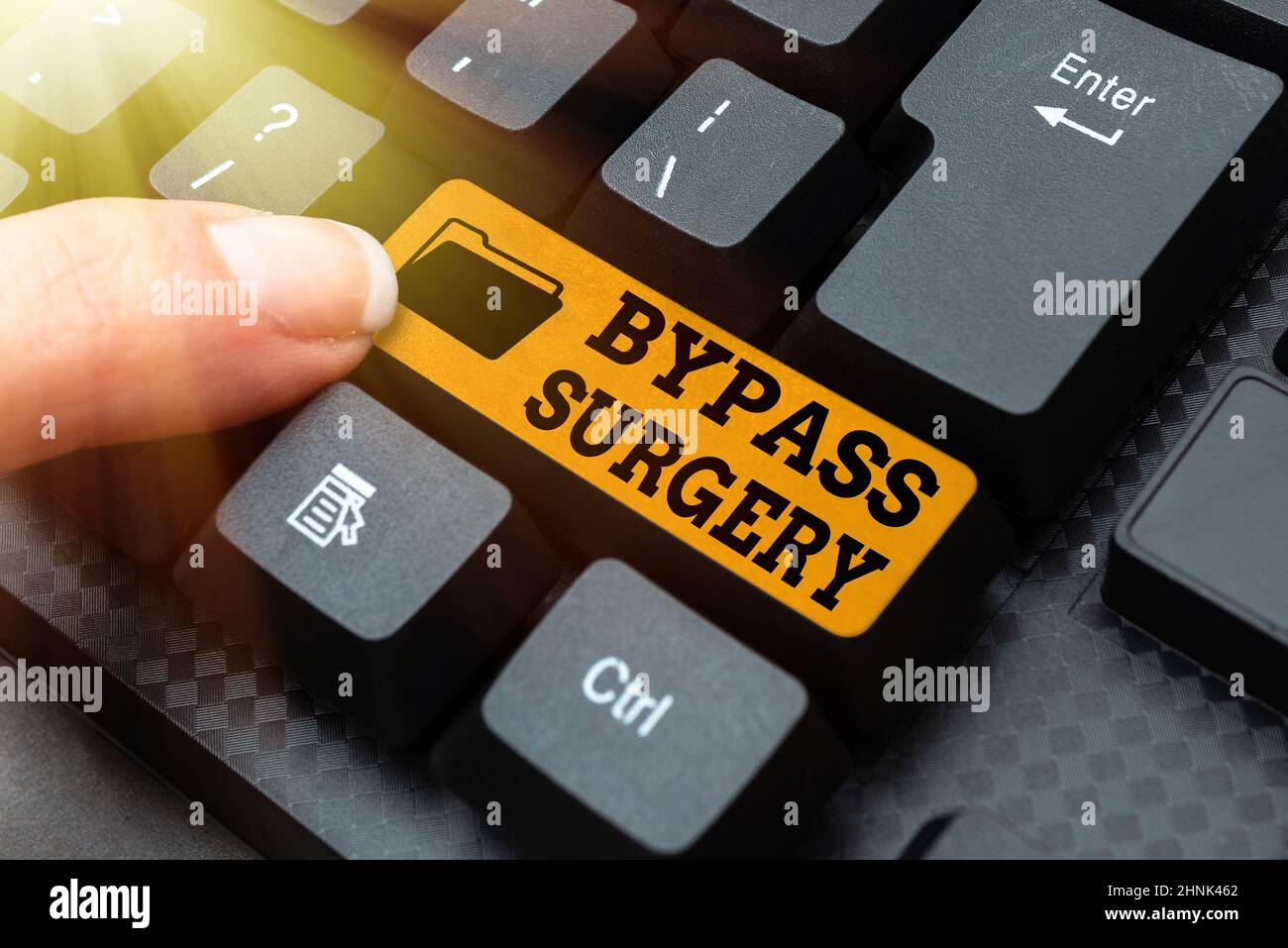 Text sign showing Bypass Surgery, Business showcase type of surgery ...