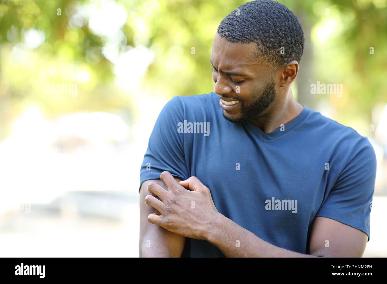 Black man scratching itchy arm walking in a park Stock Photo - Alamy