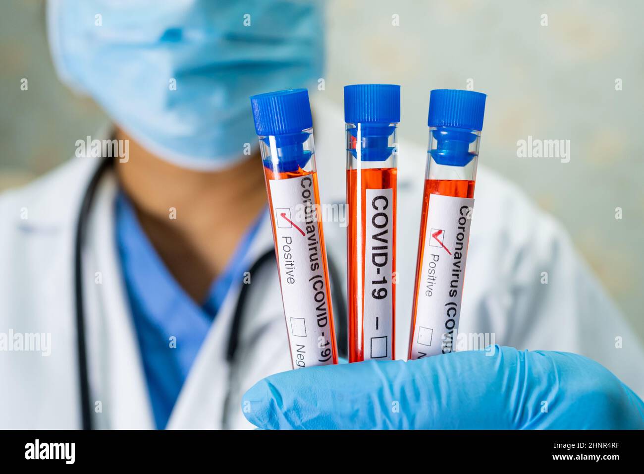 Positive blood infection sample in test tube for covid-19 coronavirus ...