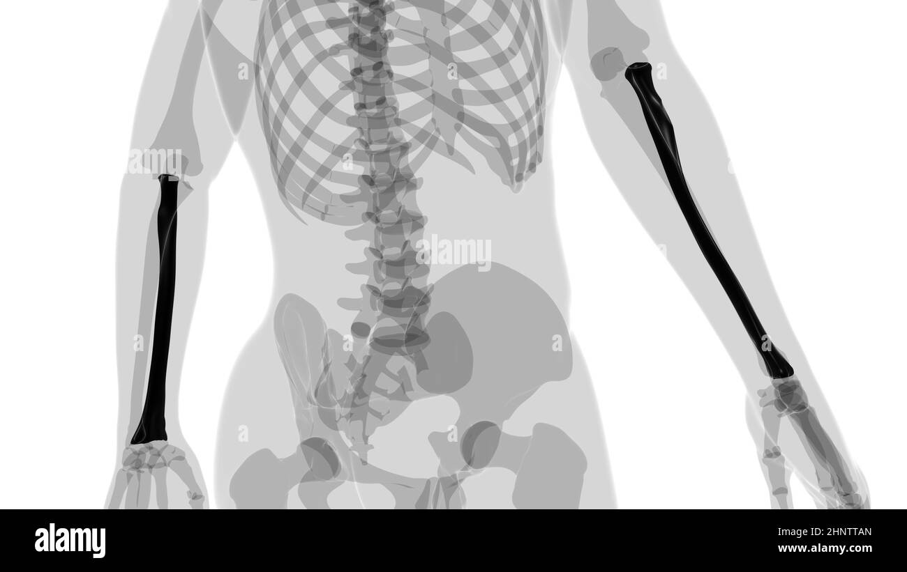 Human skeleton anatomy Radius Bone 3D Rendering For Medical Concept ...