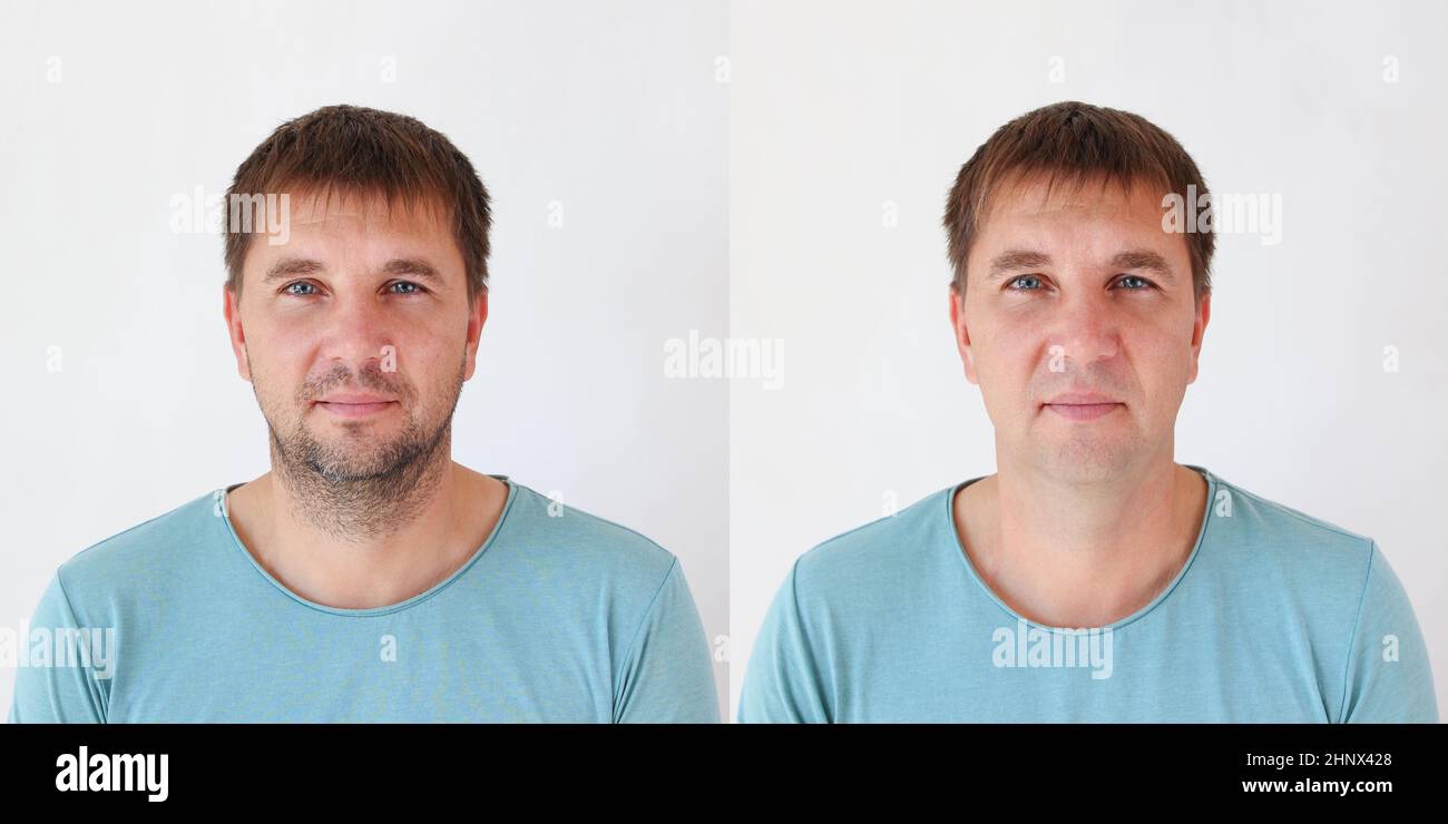 Collage of a man before and after shaving. His face is unshaven and ...
