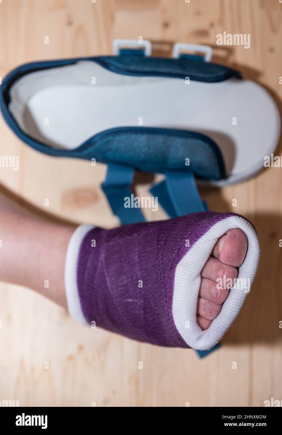 Foot crush injury hi-res stock photography and images - Alamy
