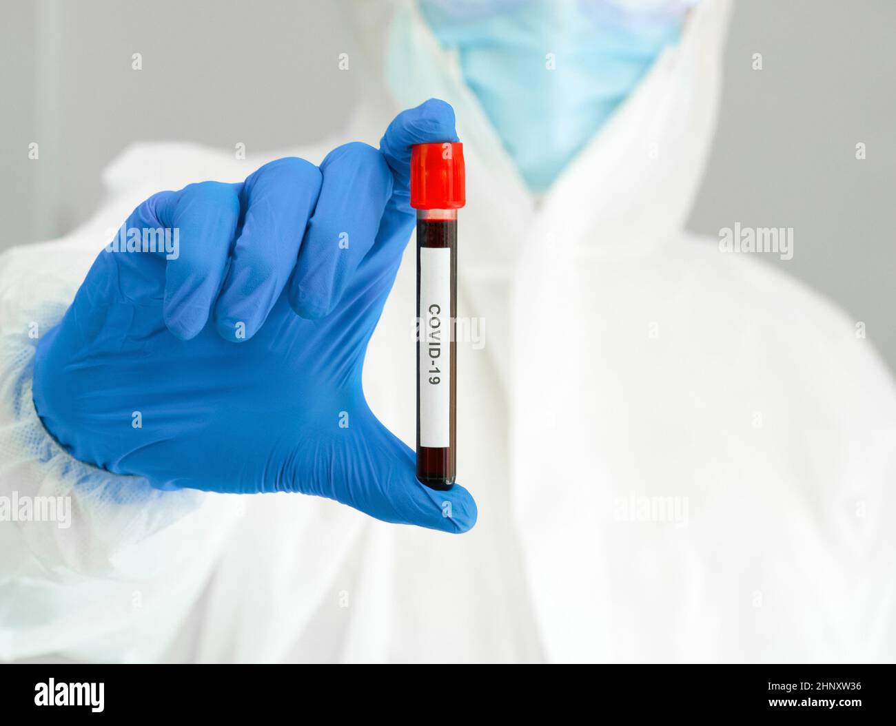 Blood sample of patient infected with Covid-19 in researcher hand ...