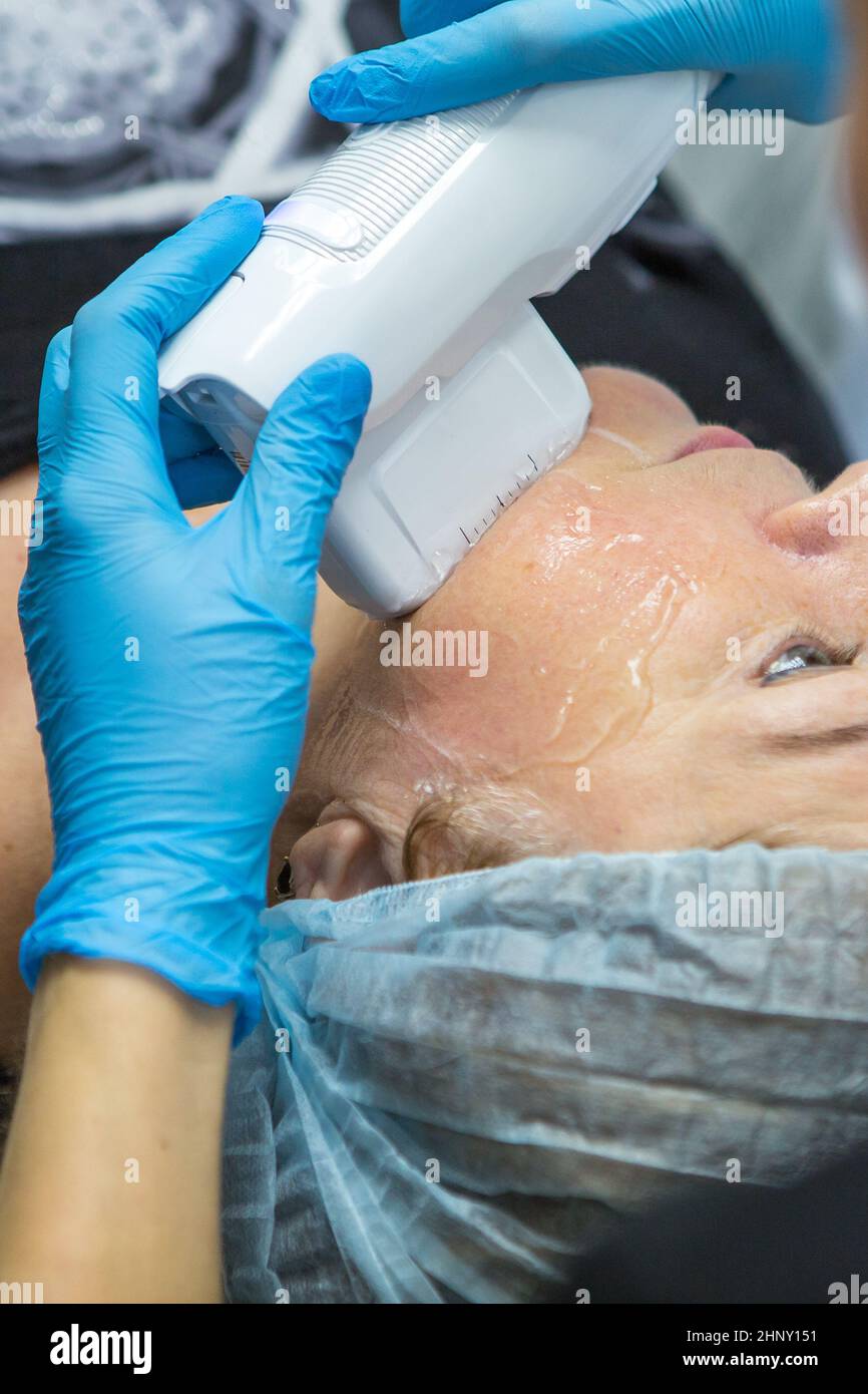 Non-surgical face lifting. SMAS lifting ultrasonic. The process of ...