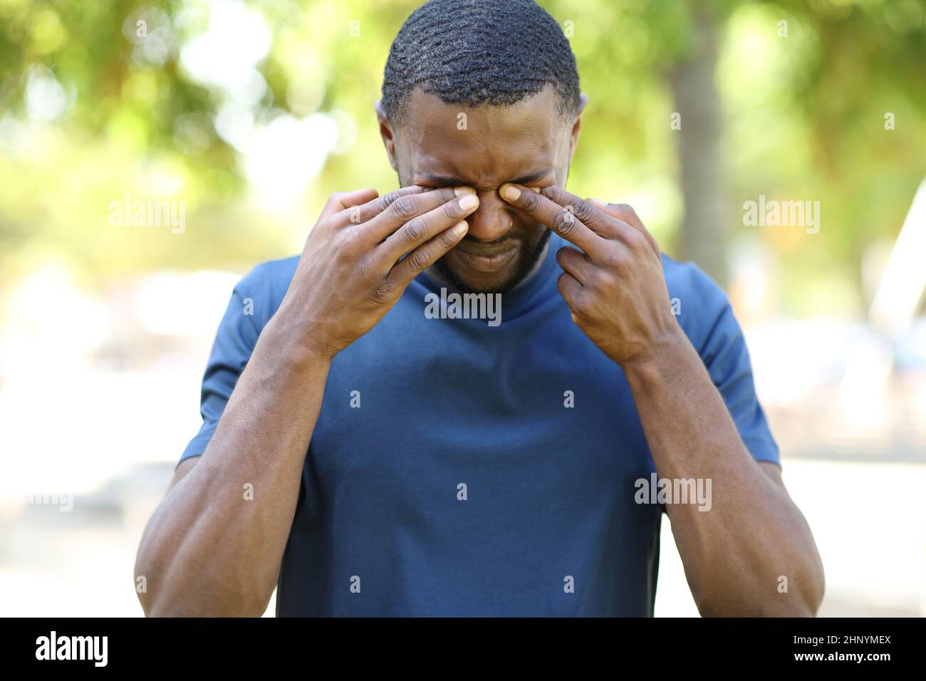 Front view portrait of a man with black skin scratching itchy eyes in a ...