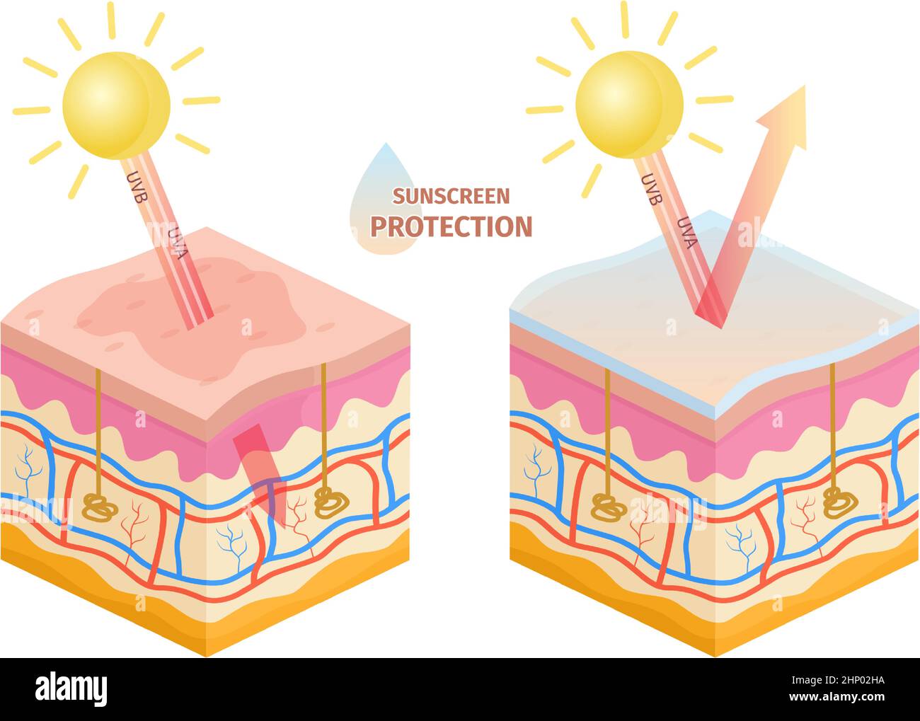 Human skin uv rays protection, before and after sunscreen. Sun uva, uvb ... Human skin uv rays protection, before and after sunscreen. Sun uva, uvb ...