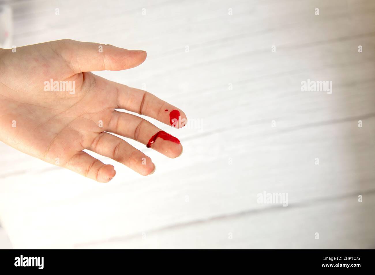 hand injury with blood, blood wound cut top view, copy space, medical ...