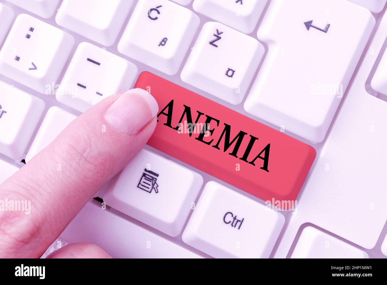 Conceptual display Anemia, Internet Concept condition where there ... Conceptual display Anemia, Internet Concept condition where there ...