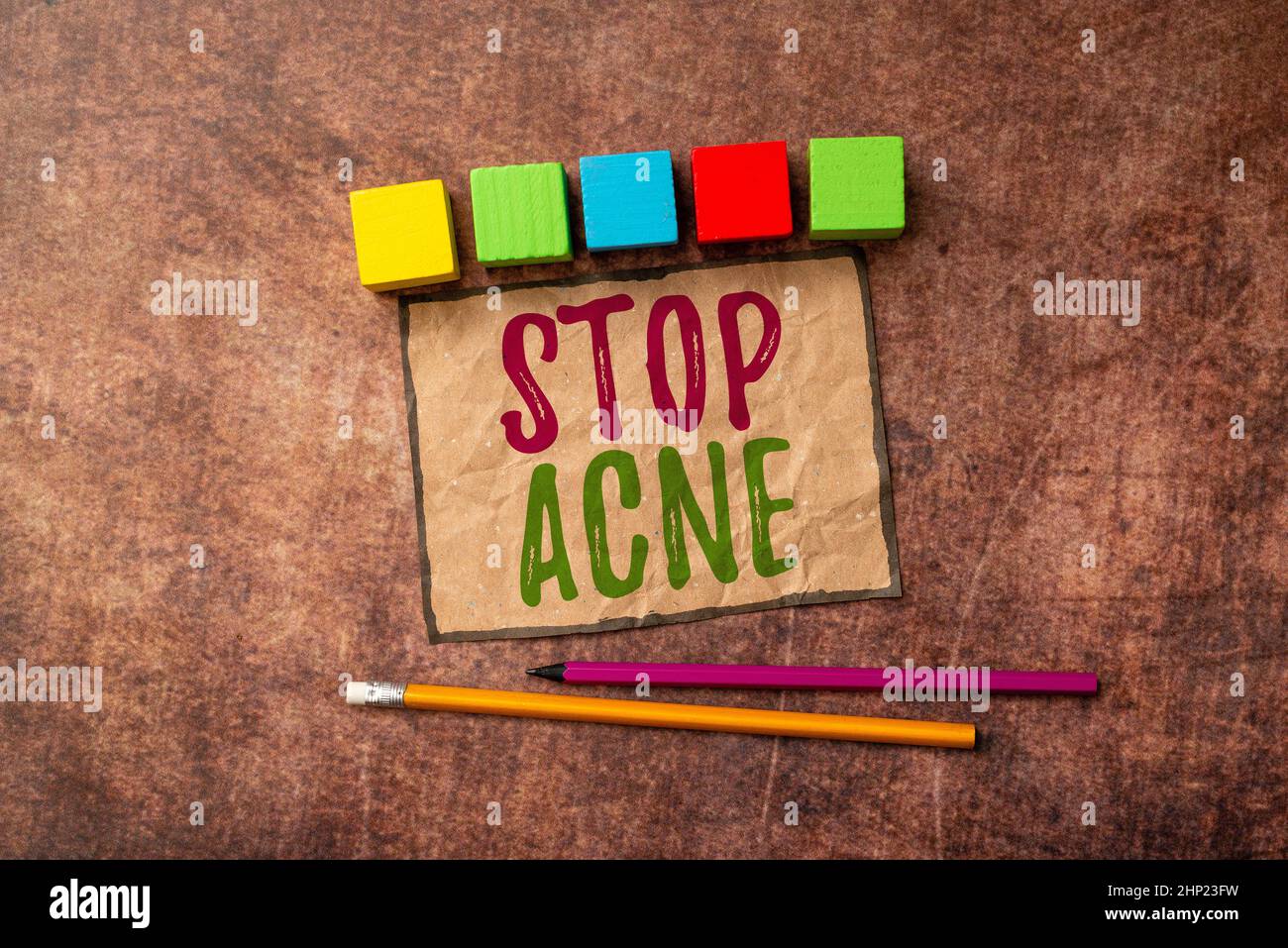 Writing displaying text Stop Acne, Business overview control the ...