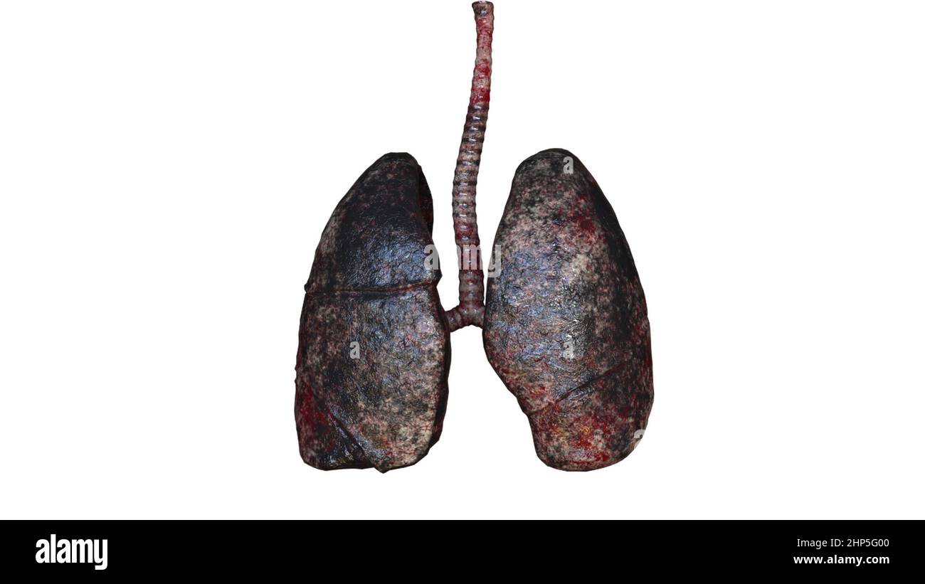 Respiratory organs darkened from resins with 3d render unhealthy spots ...