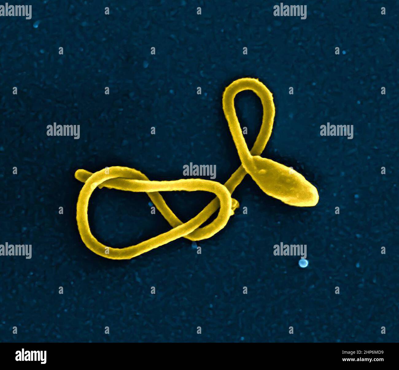 This scanning electron micrograph shows a single filamentous Ebola ...