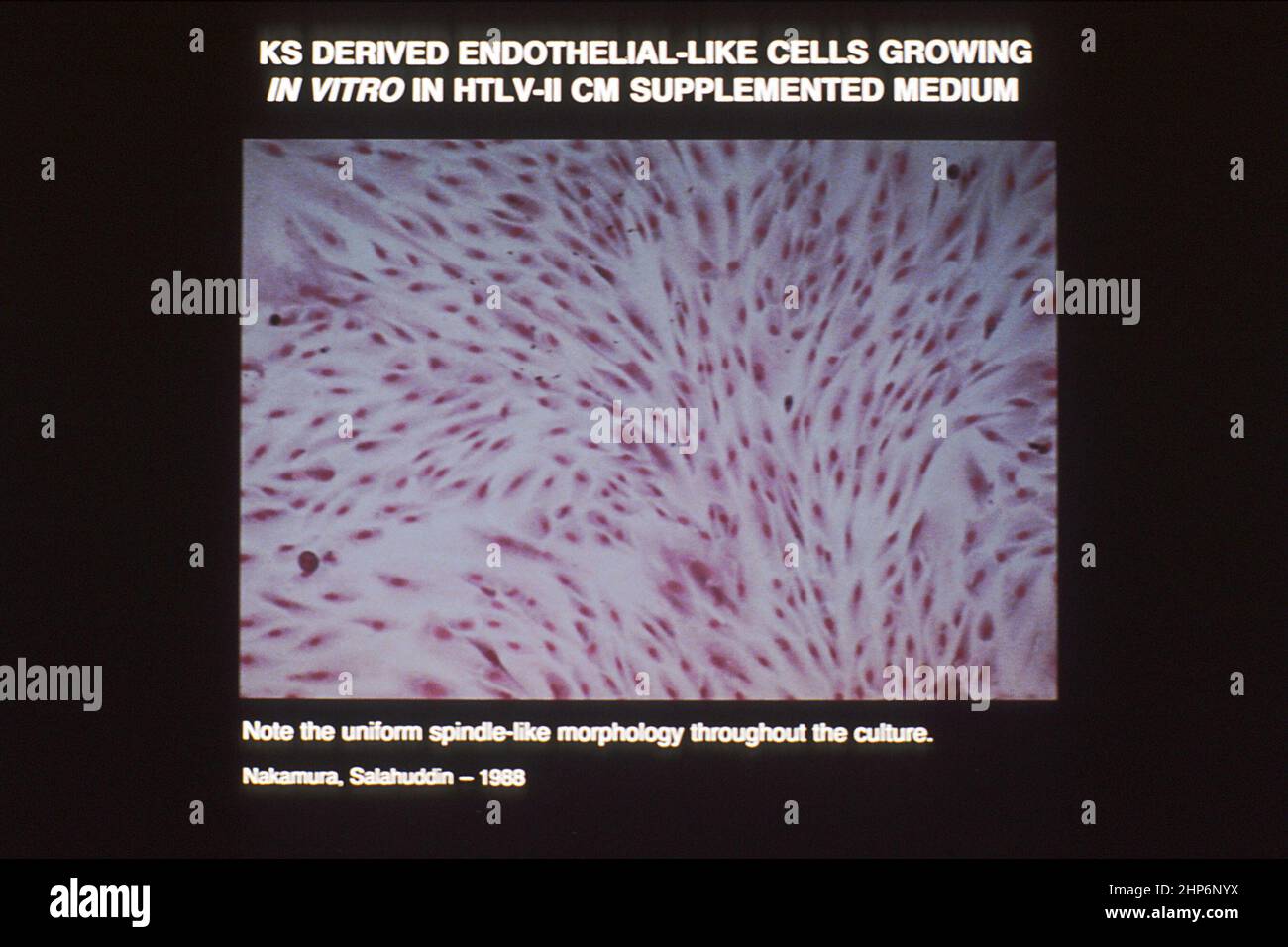 In vitro (tissue culture). Long-term cultured confluent AIDS-KS cells ...