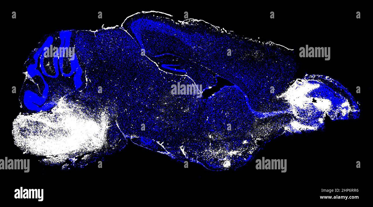 This image shows the brain of a mouse with cerebral malaria. White ...