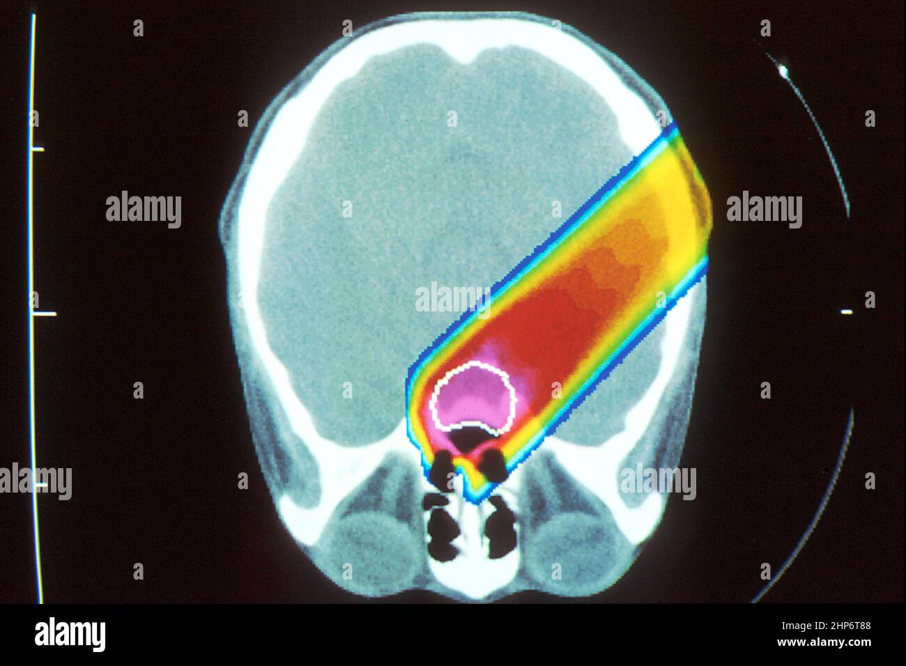 1989 ct scan hi-res stock photography and images - Alamy
