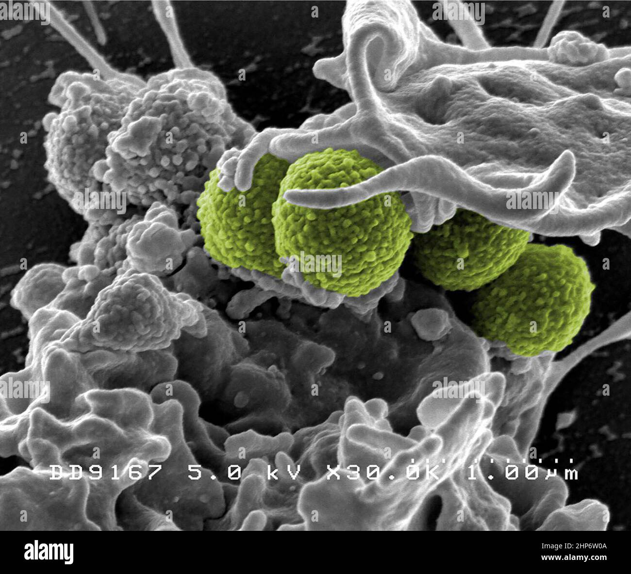 Interaction of MRSA (green bacteria) with a human white cell. The ...