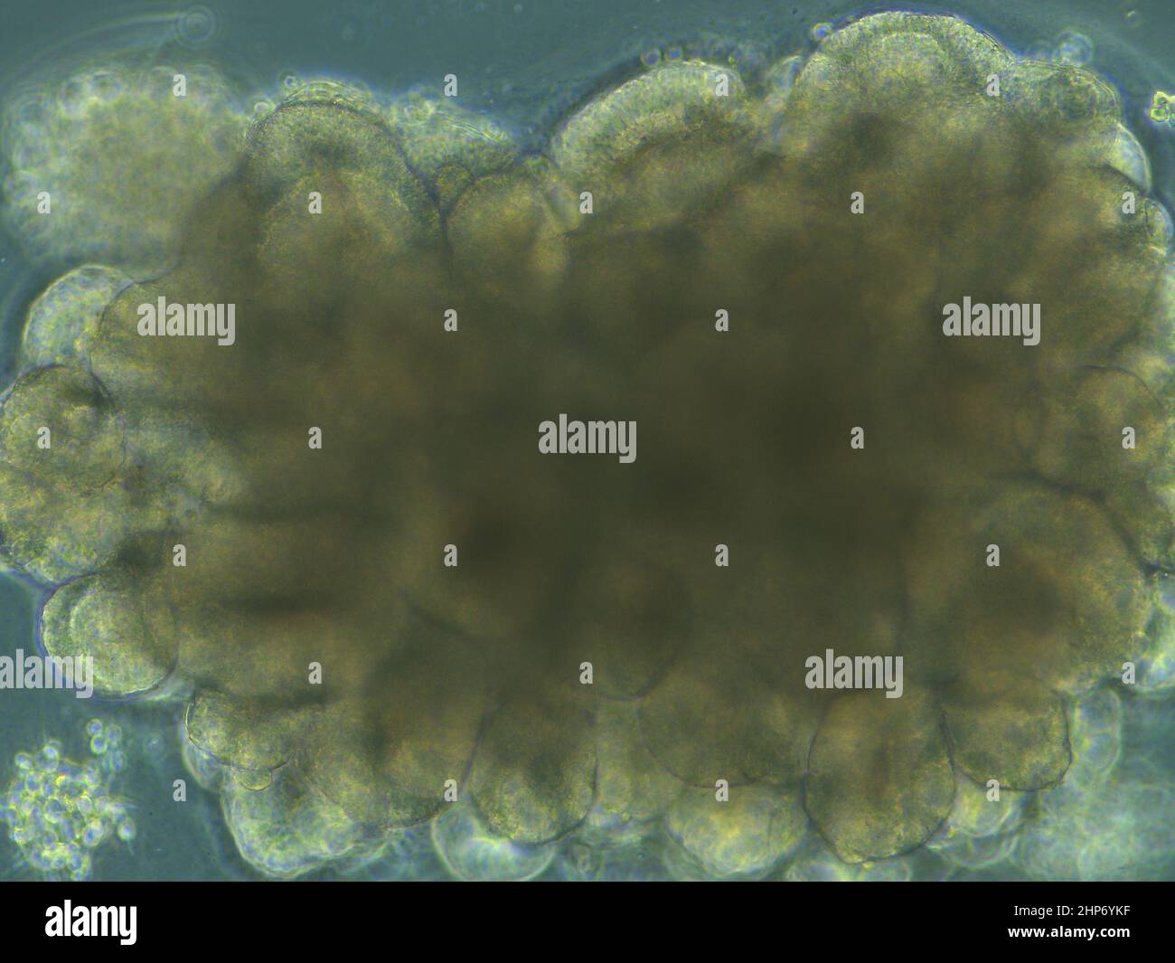 This photo is a Brightfield microscope image of an organoid during ...