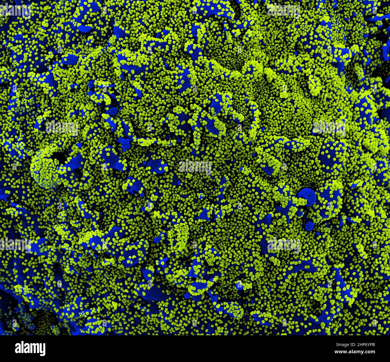 Colorized scanning electron micrograph of a cell (blue) heavily ...