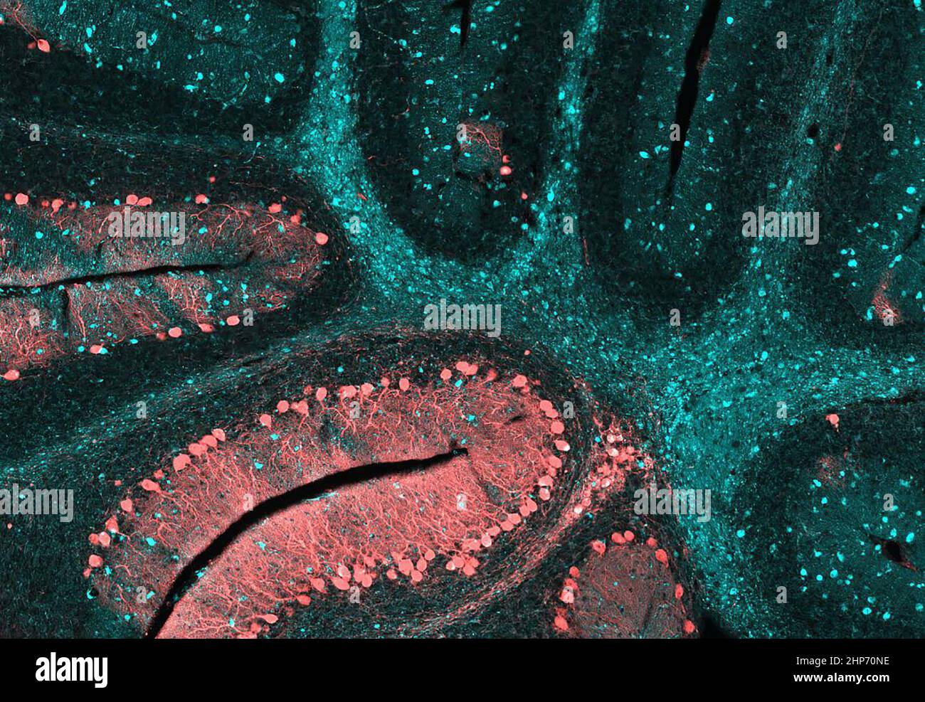 The cerebellum of a mouse brain affected by Niemann-Pick Type C (NPC ...