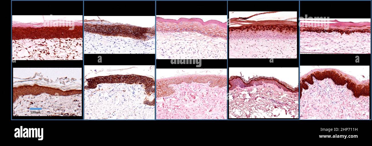 Histology is the gold standard to determine the architecture of tissues ...