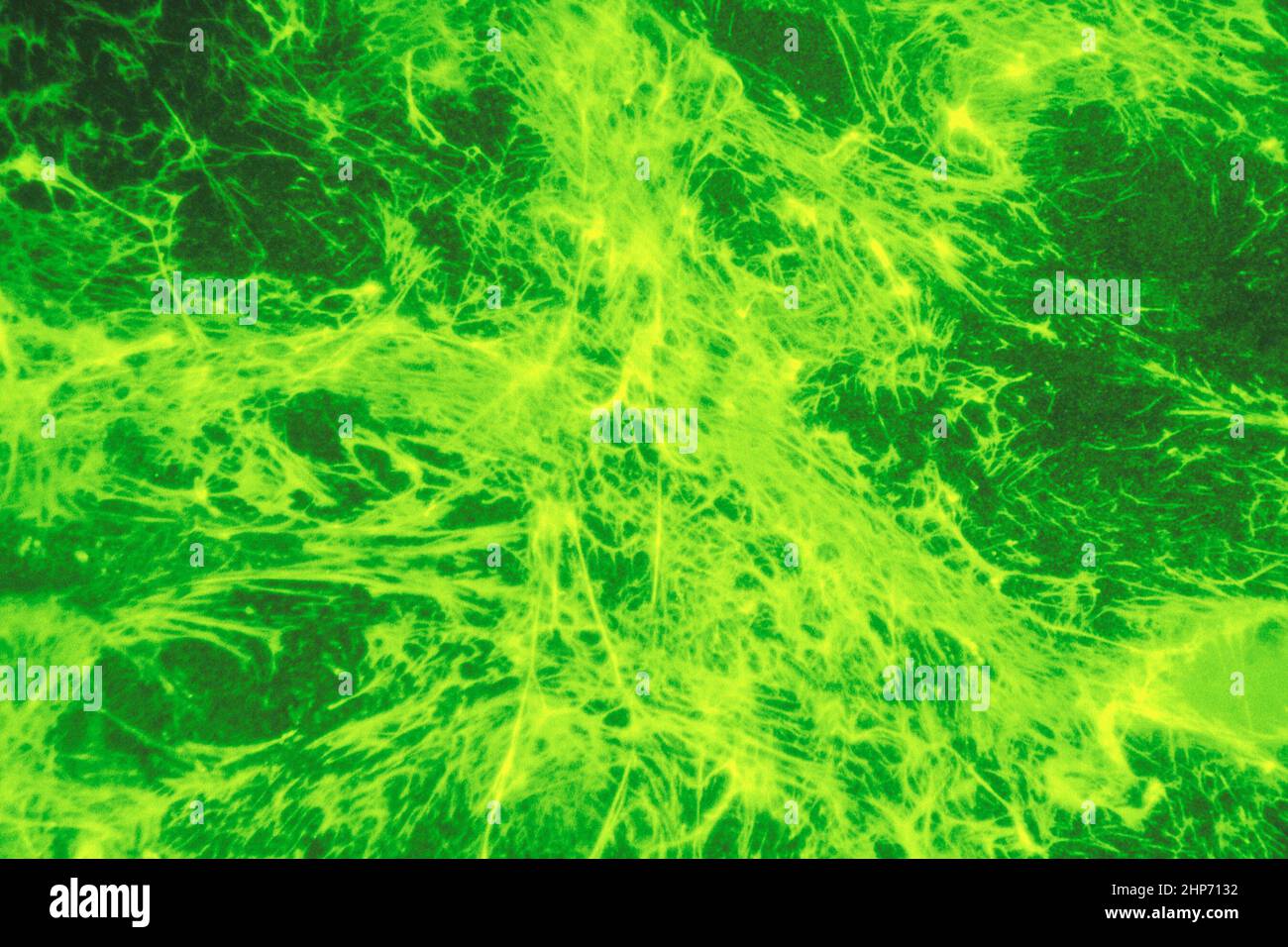 Fluorescent-labeled fibronectin on a layer of cells. It appears to be ...