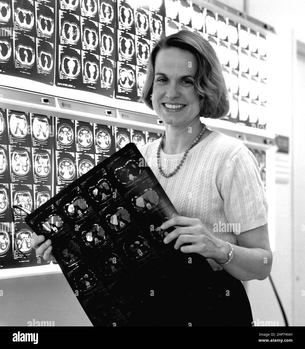 Medical history, cancer Black and White Stock Photos & Images - Alamy