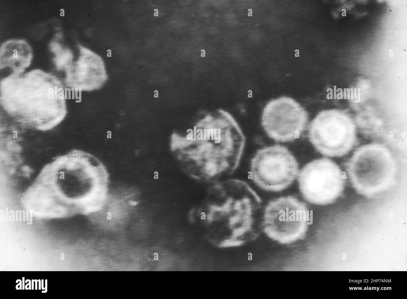 Epstein-Barr virus taken through an electron microscope ca. 1980 Stock ...