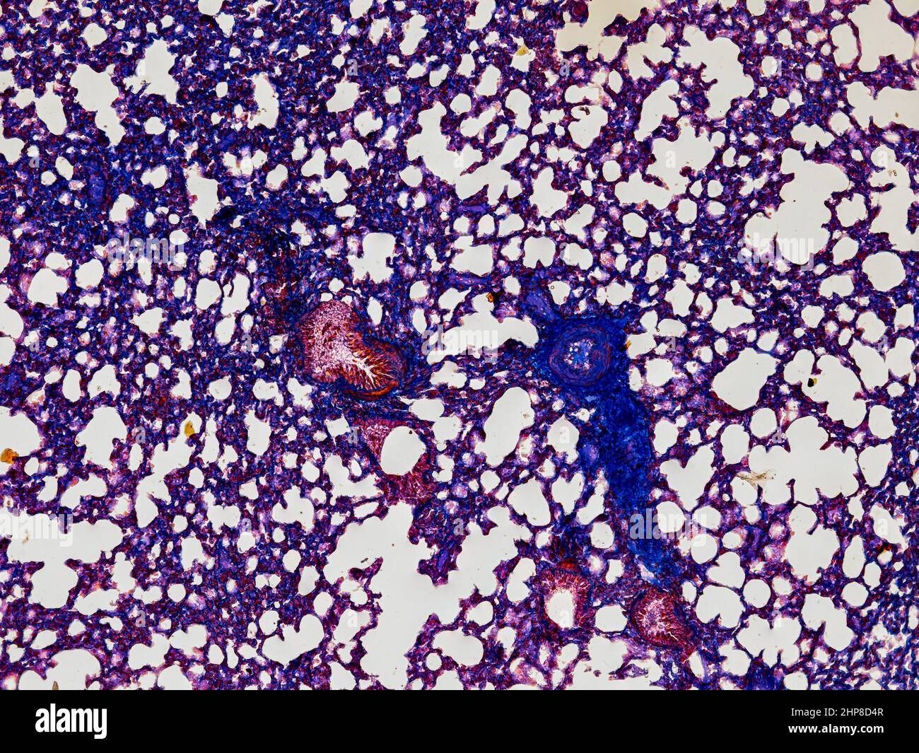microscope view of 10 micron cross section of a lung tissue - light ...