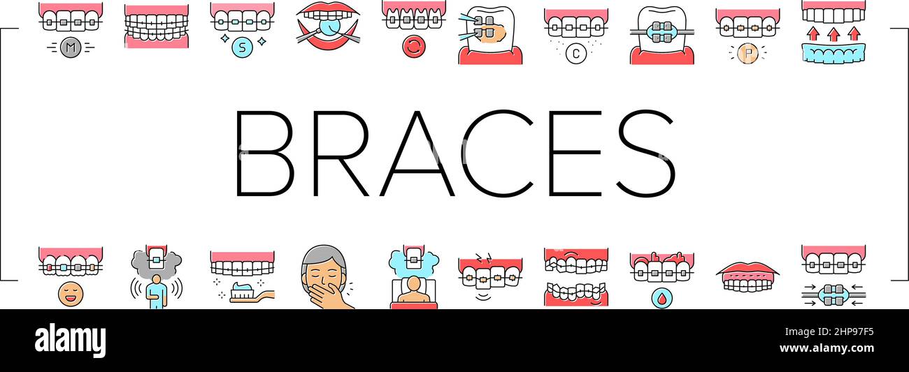 Tooth Braces Accessory Collection Icons Set Vector Stock Vector Image ...