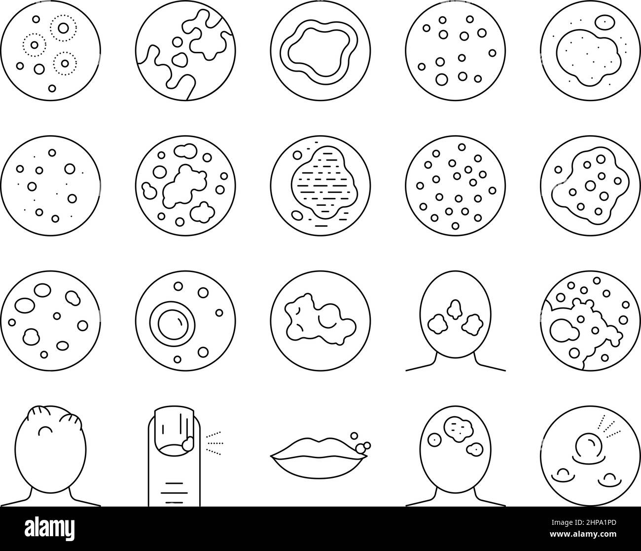 Skin Disease Symptom Collection Icons Set Vector Stock Vector Image ...