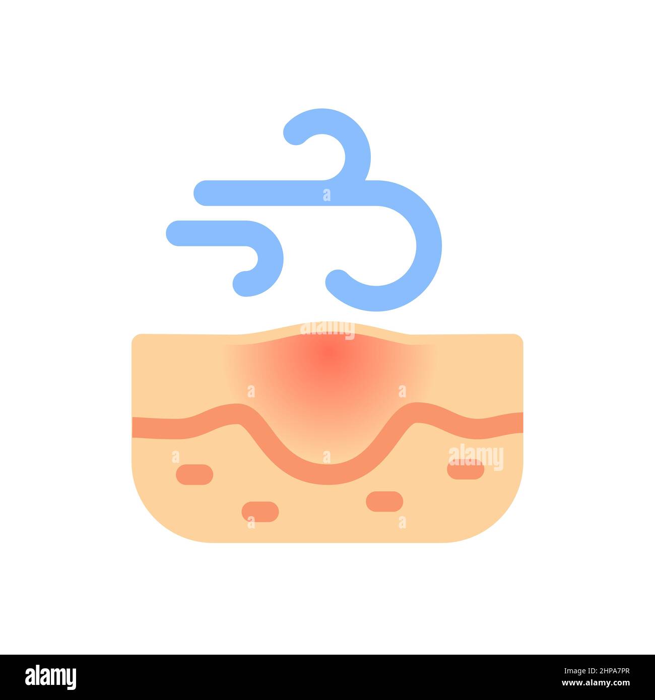 irritation calm skin epidermis dermatology single isolated icon with ...