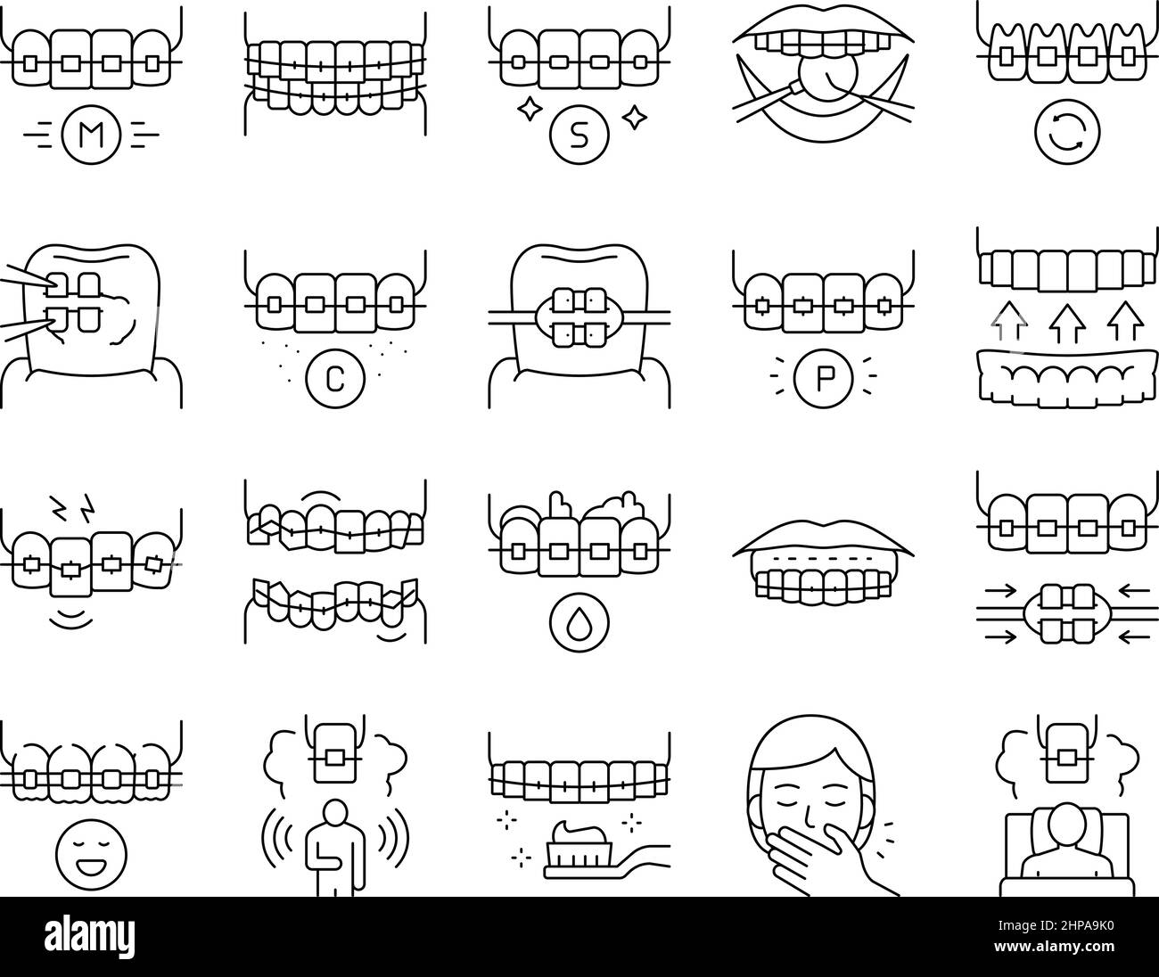 Tooth Braces Accessory Collection Icons Set Vector Stock Vector Image ...