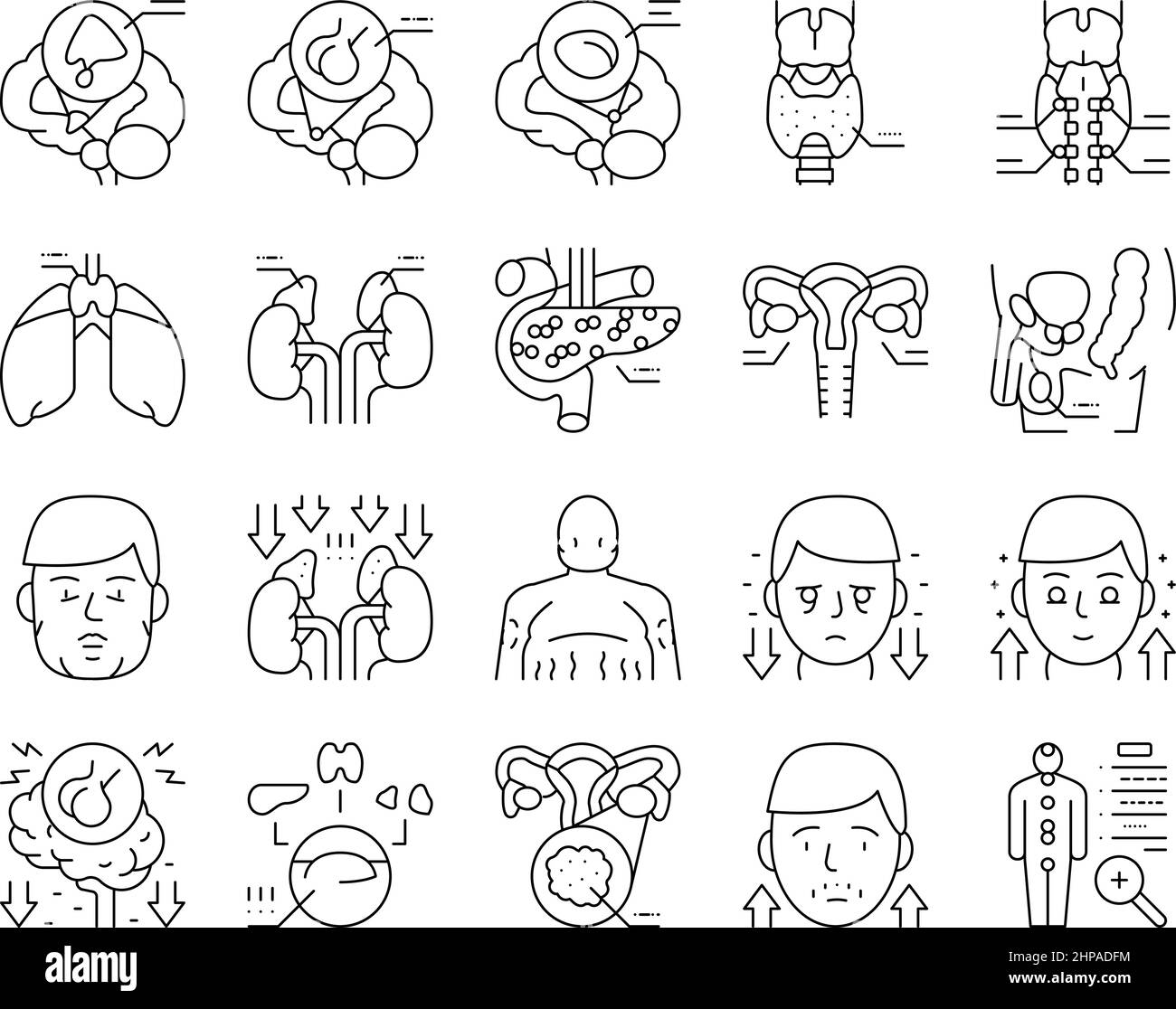 Multiple endocrine neoplasia disease hi-res stock photography and ...