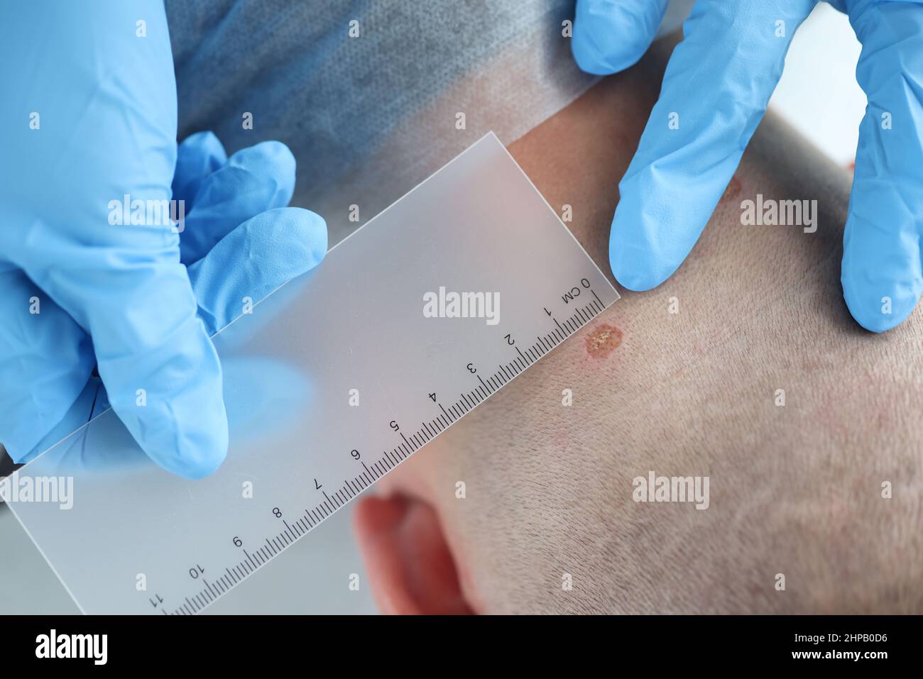 Dermatology clinic hi-res stock photography and images - Alamy
