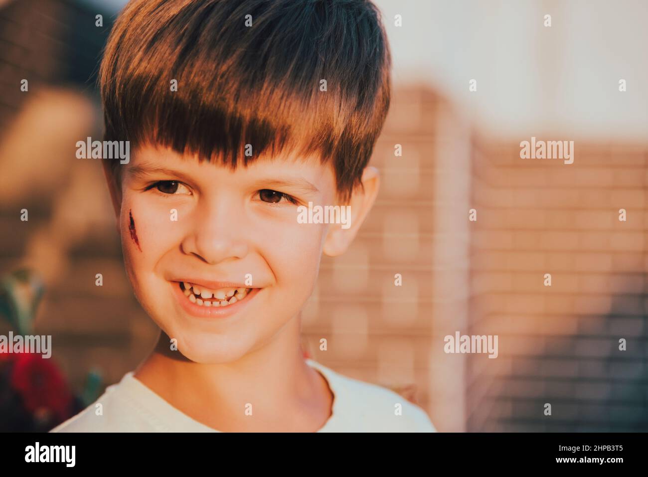 Portrait of a smiling boy with a scar on his face Stock Photo - Alamy