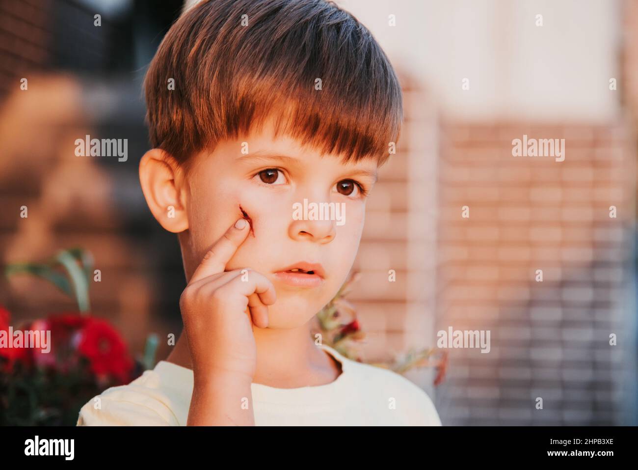 Portrait of a beautiful child with a scar on his face Stock Photo - Alamy