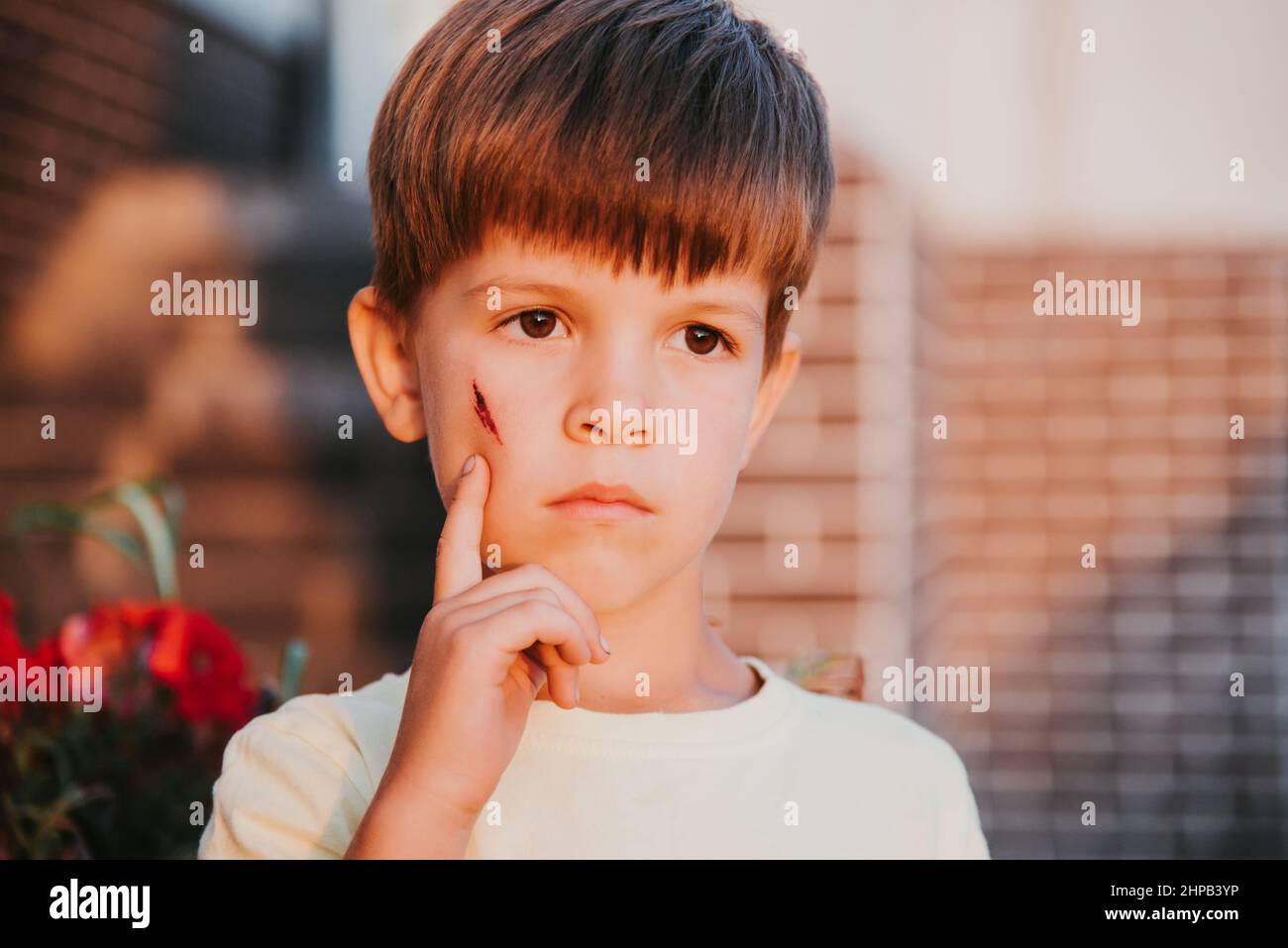 Portrait of a beautiful child with a scar on his face Stock Photo - Alamy