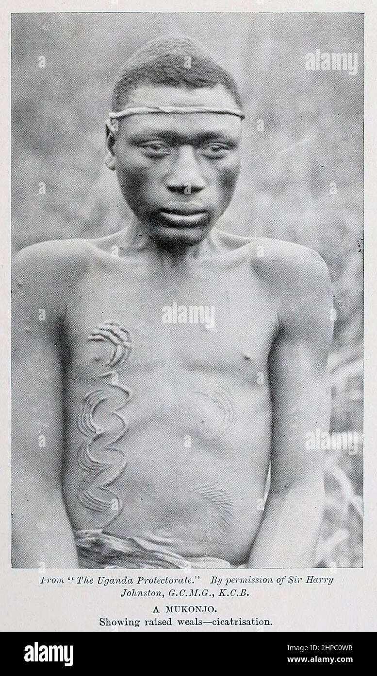 A MUKONJO. Showing raised weals — cicatrisation The Konzo (pl. Bakonzo ...