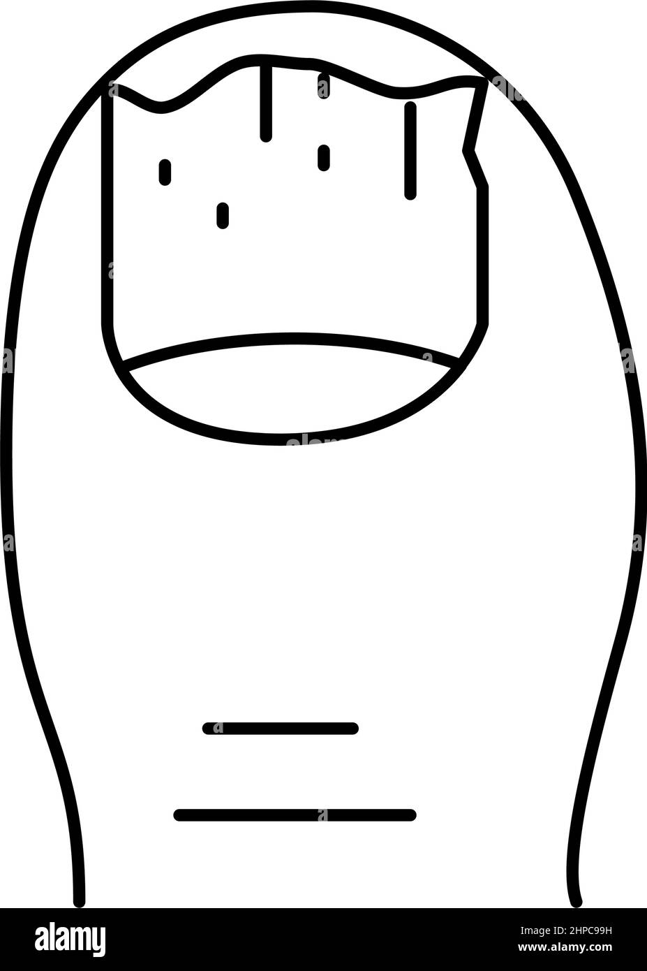 onychomycosis nail disease line icon vector illustration Stock Vector ...