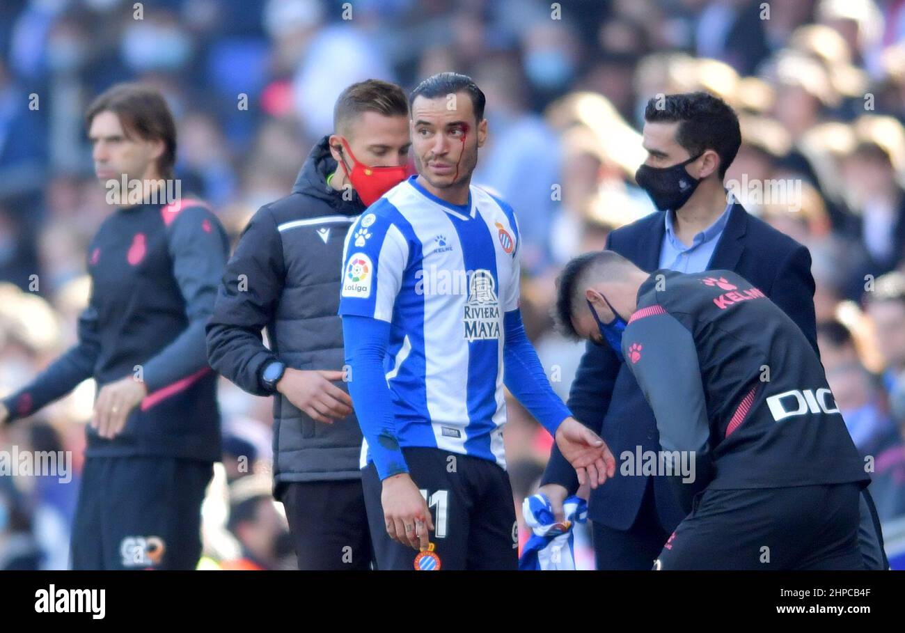 Soccer football blood bleeding hi-res stock photography and images - Alamy