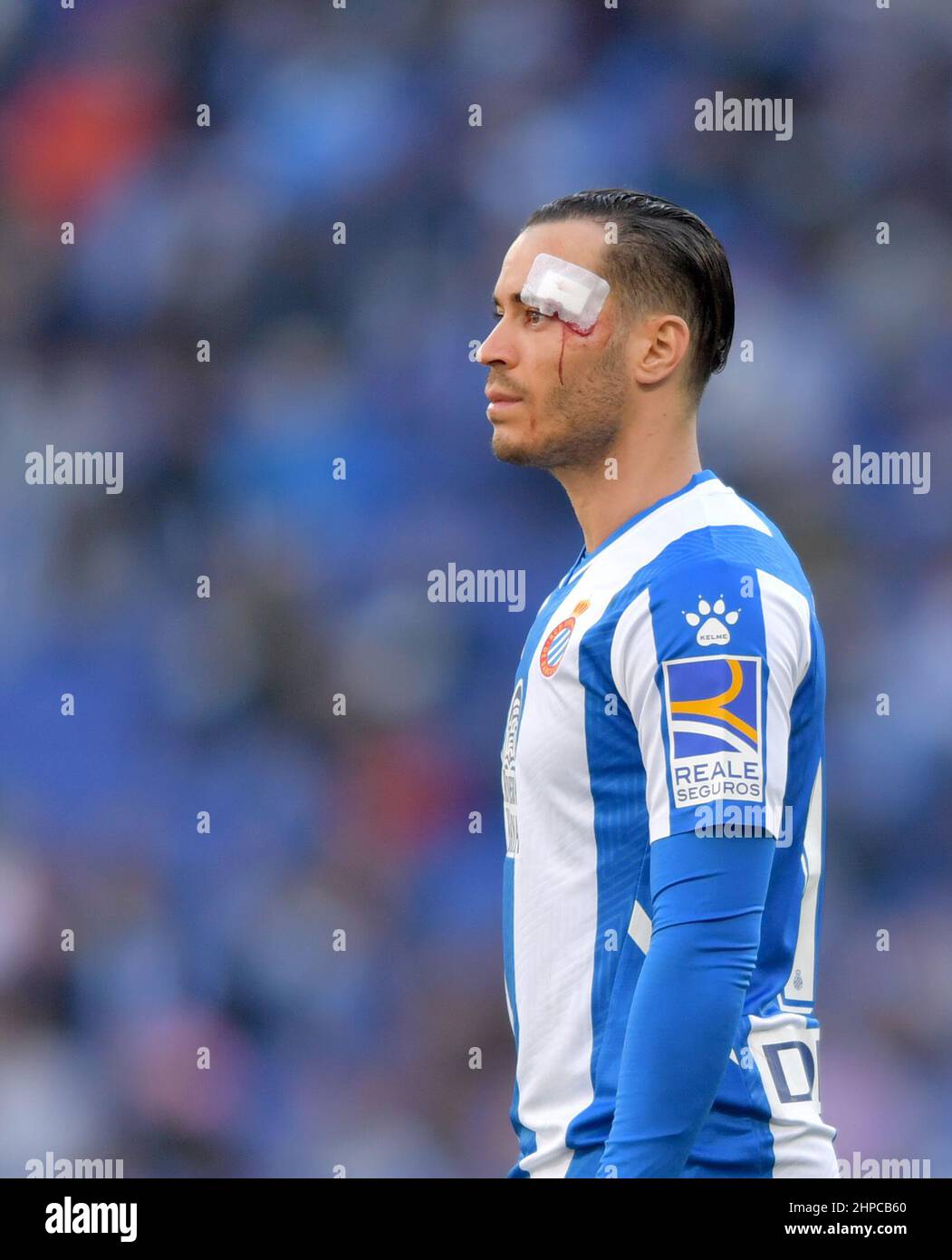 Soccer football blood bleeding hi-res stock photography and images - Alamy